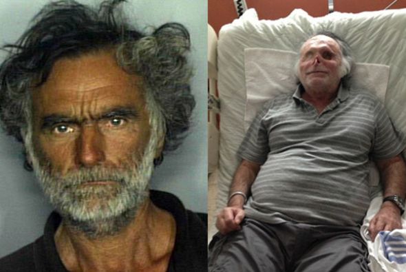 Víctima de famoso caníbal se recupera - Univision