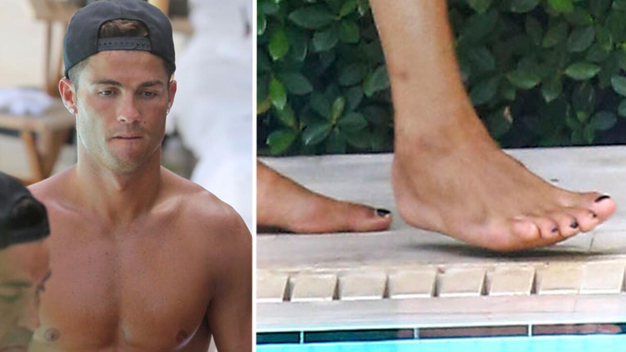 Cristiano Ronaldo con las uñas de los pies pintadas - Univision